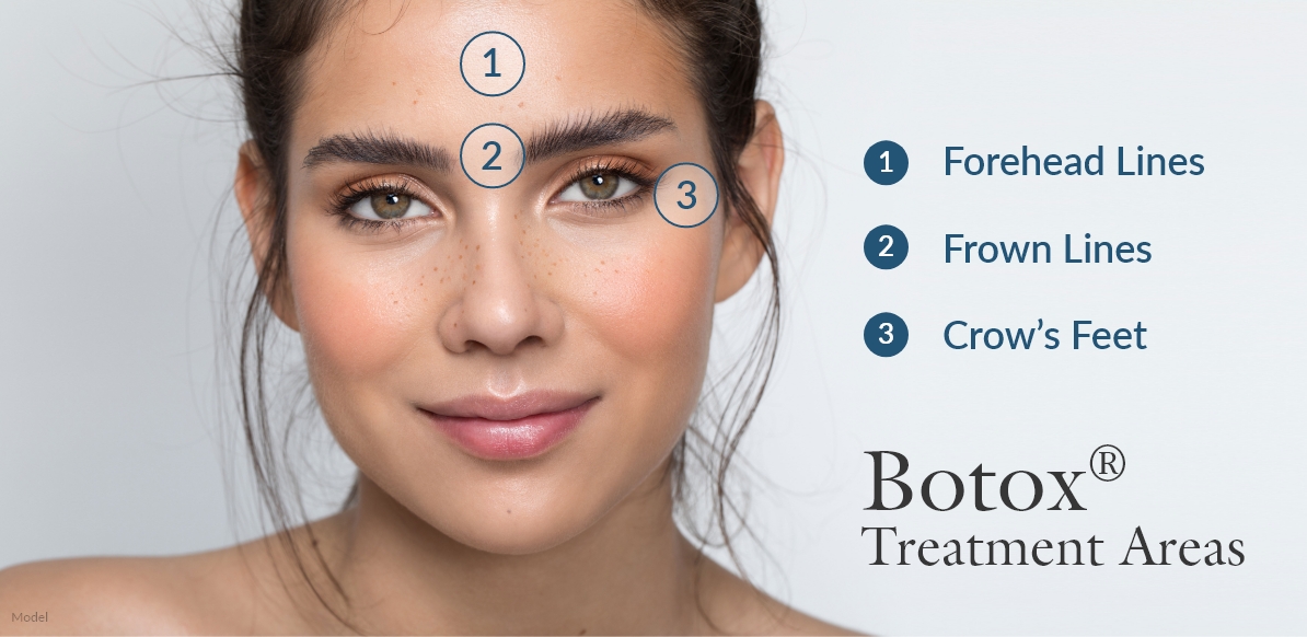 BOTOX® & Dysport® Burbank & Glendale – Armen Vartany, MD, FACS: Plastic ...